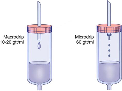 Microdrip Chamber Is Used If Fluid Will Be Infused At A Slow Rate