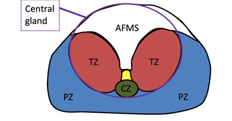 Prostate Gland Zones Prostate Gland Zones