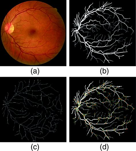 The Original Image Manual Segmentation Data Used In Our Retinal Download Scientific Diagram