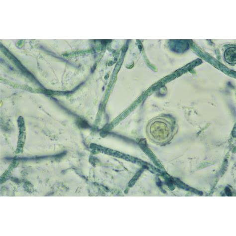 Pythium Aphanidermatum Medical And Science Media