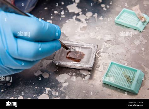 Scientist Embedding Tissues In Paraffin Blocks For Sectioning Pathology Laboratory Cancer