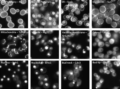 Yeast Protein Localization Classified Using Truai™ Deep Learning