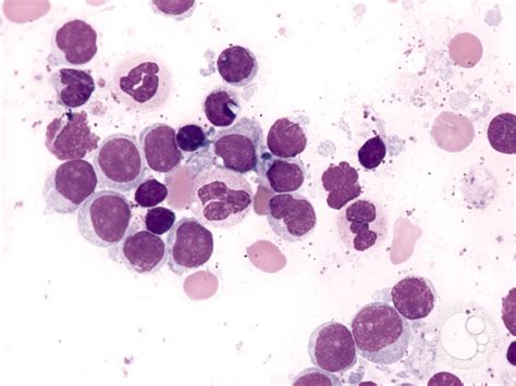 Precursor T Cell All 10