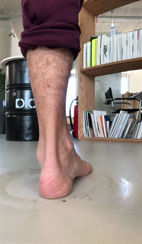 Foot Pose Classifier Full Dataset Classification Dataset By Public