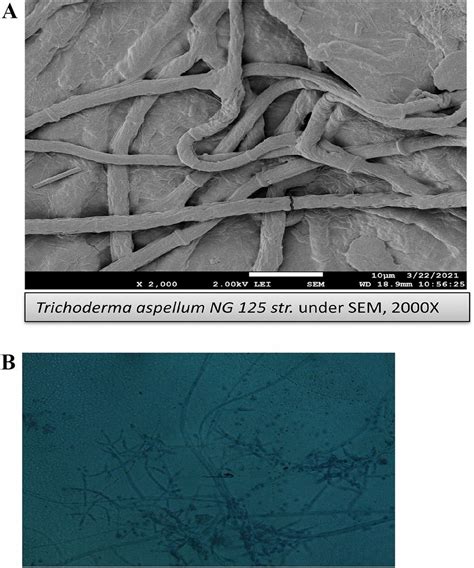 A Sem Image Of Trichoderma Asperellum 2000× B Compound Microscopic