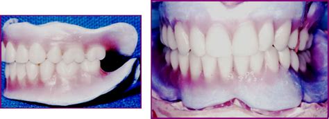 Dentistry And Medicine Concept Of Neutral Zone