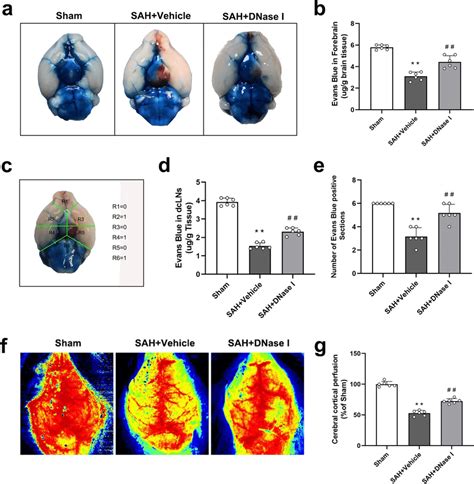 Administration Of Dnase I Attenuated Csf Flow Disorder And Improved Download Scientific Diagram