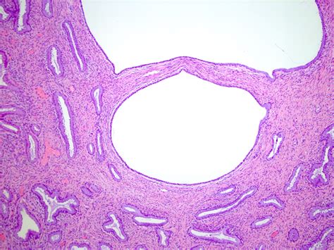 Endocervix Histology