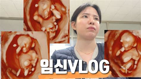 임신VLOG 주부터 주까지 임산부 일상 임산부 브이로그 차 기형아검사 무사히 통과 첫 입체초음파 직장인 임산부 YouTube