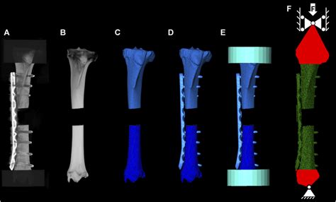 Fe Model Building Workflow Instrumented Ct Scan Used To Quantify The