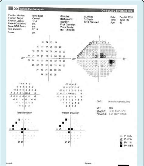 b central 24 2 visual field at 15 weeks download scientific diagram