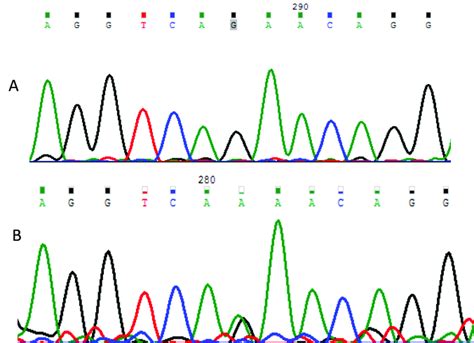 Dna Sequence From Intron 11 12 Of Rb1 Gene A The Reference Sequence