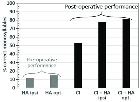 Preoperative Freiburg Monosyllabic Word Scores Tested With The