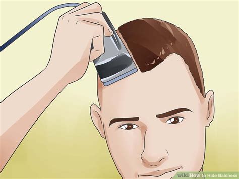 3 Ways To Hide Baldness WikiHow 3 Ways To Hide Baldness WikiHow