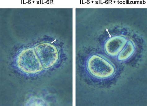 Extracellular Matrix Production From Human Articular Chondrocytes