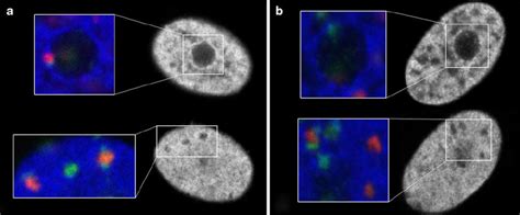 Nucleoli And Chromocenters In Mule Fibroblasts Confocal Sections Of
