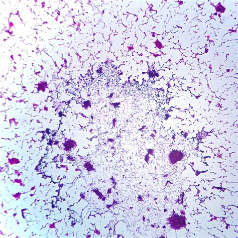 Stagnant Water Bacteria Wm Microscope Slide Carolina Biological