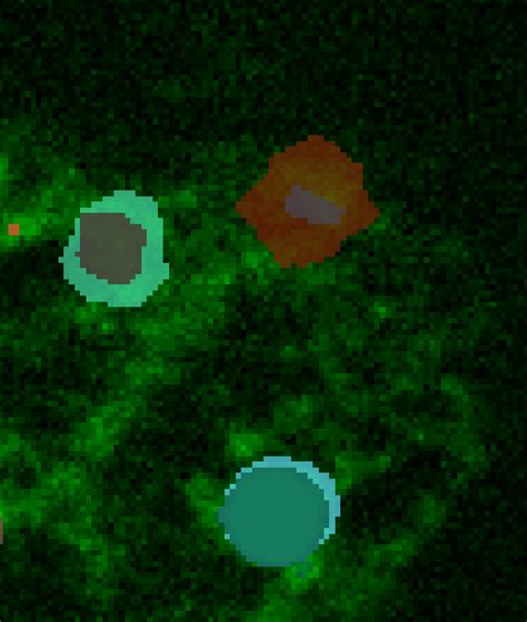 Next Steps Post Segmentation Feature Extraction Image Analysis
