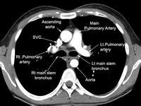 17 Ct Scan Ideas Ct Scan Radiology Radiology Imaging