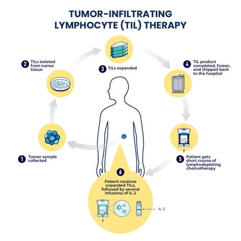 Asco 2025 News Lifileucel Produces Long Term Responses And Survival In Advanced Melanoma The