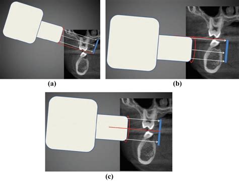 Parallel Technique Dental X Ray Dog At Antonio Christie Blog Parallel Technique Dental X Ray Dog At Antonio Christie Blog