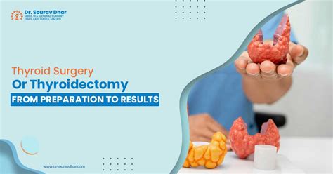 Thyroid Surgery In Siliguri Dr Sourav Dhar