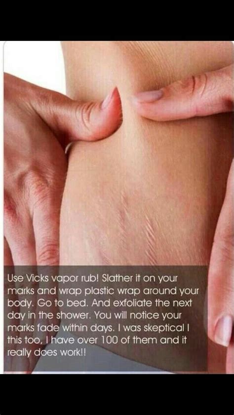 Best 11 How To Get Rid Of Ingrown Hairs Artofit