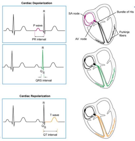 Ecg Flashcards Quizlet