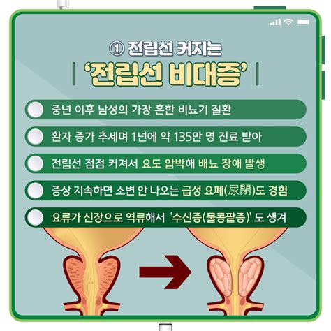 전립선 비대증 And 전립선암