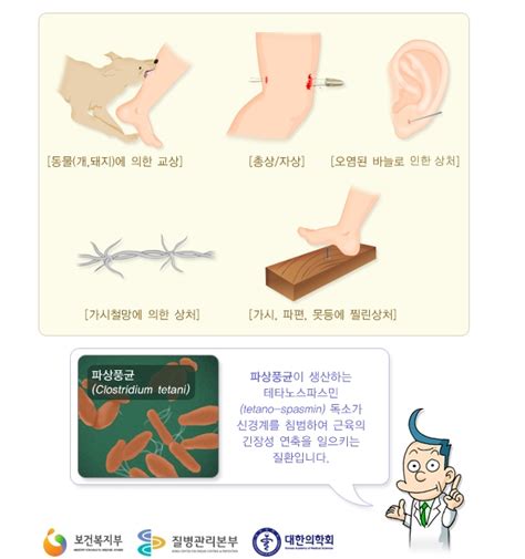 건국대병원 “파상풍 예방주사 성인도 10년에 한 번씩 접종” Save Internet 뉴데일리