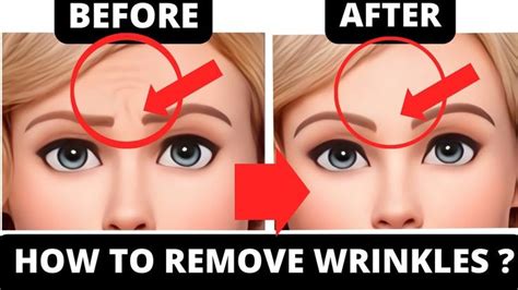 HOW TO REMOVE WRINKLES GET RID OF FROWN LINES VERY EFFECTIVE FACE LIFTING EXERCISES Face