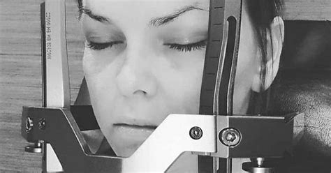 Gamma Knife Album On Imgur