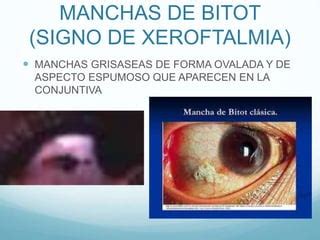 Evaluación Clínica Del Estado Nutricional Ppt