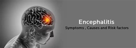Encephalitis Understanding The Brain Inflammation That Demands