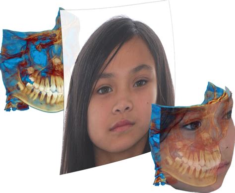 Dolphin 3d Imaging Software Dolphin Imaging Software