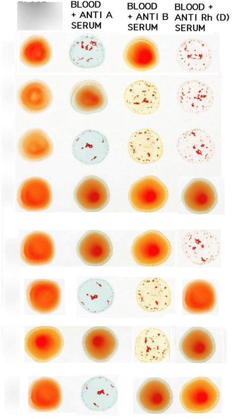 Blood Typing Diagram Quizlet