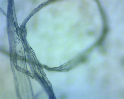 The Lyme Threadworm Nematomorph Stage Is Actually Magnificent Views At 2500x And 1000x R