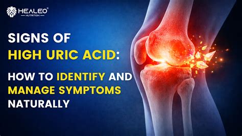 Signs Of High Uric Acid How To Identify And Manage Symptoms Naturally