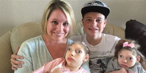 Microcefalia Causas Diagnóstico Tem Tratamento