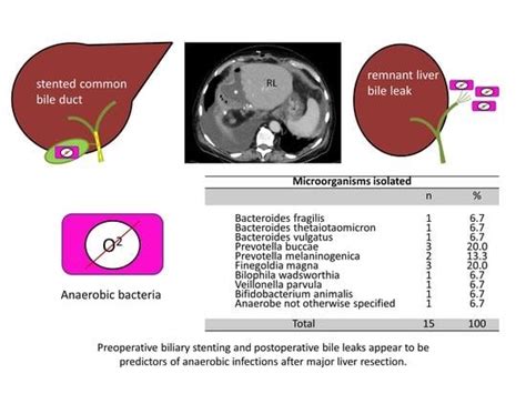 Anaerobic Bacterial Infections