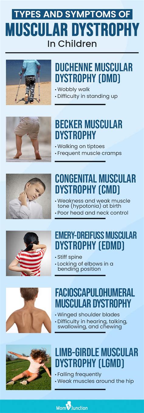 How To Diagnosis Muscular Dystrophy At Aiden Ligar Blog