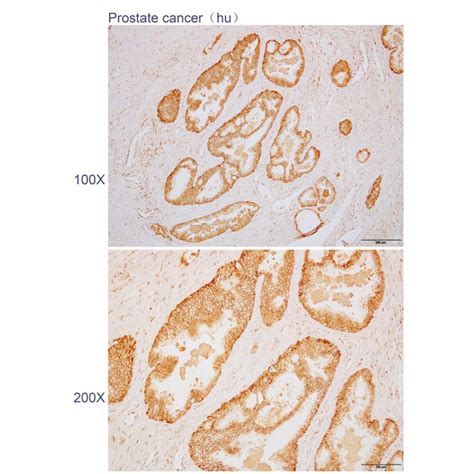 Solarbio K110550P Anti BSG Polyclonal Antibody 试剂仪器耗材