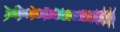 3d Reconstruction Of Thoracic Vertebrae Download Scientific Diagram