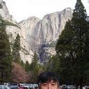 PDF Arnold Chiari I Malformation With Tip Toe Gait A Case Report