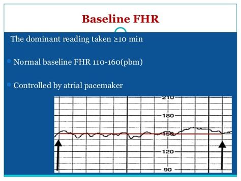 Fetal Monitoring For Undergraduate
