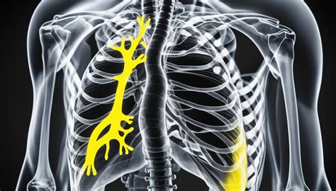 Complete Guide To Chest X Ray Cpt Code