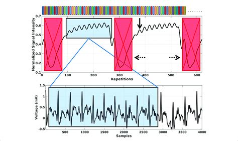 Representative Image Showing The Cardiac And Respiratory Motion Download Scientific Diagram