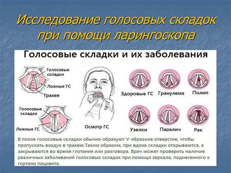 Нарушения голоса - презентация онлайн