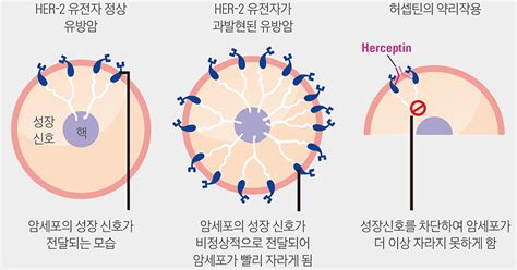 제약업계의 뜨거운 감자 암 치료 기존 항암치료의 단점을 극복하는 3세대 치료제 기술과혁신 웹진