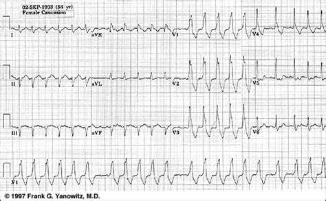 ECG Learning Center An Introduction To Clinical Electrocardiography